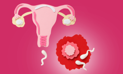 Ovulation Induction in Bangalore | Mamatha Fertility & IVF